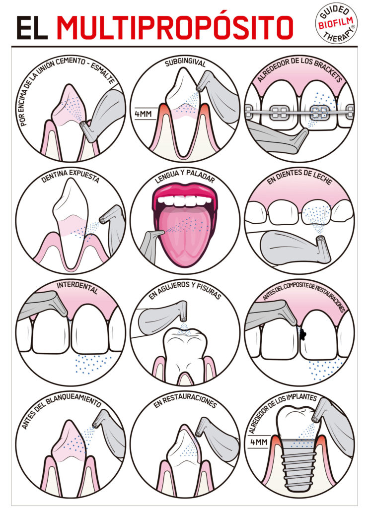 Protocolo GBT - Clínica Dental Odontic by Dra. María J. Pérez